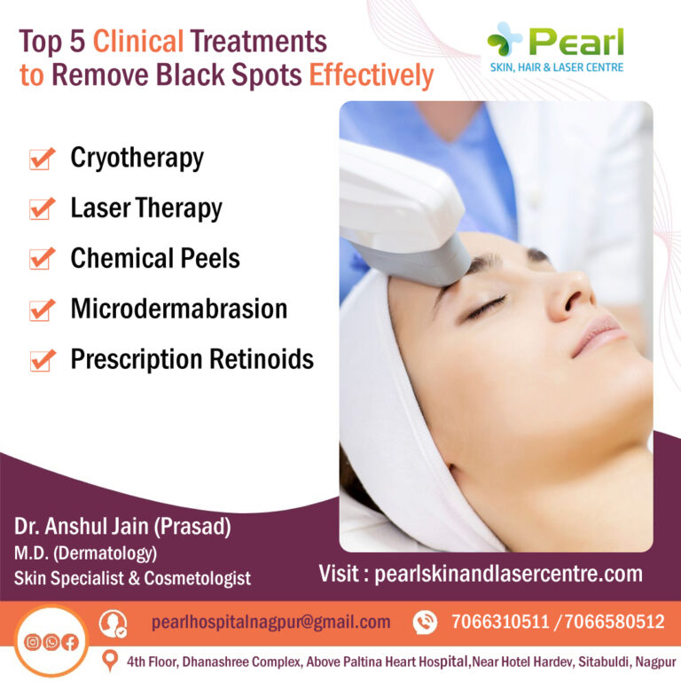 Top 5 Clinical Treatments to Remove Black Spots Effectively